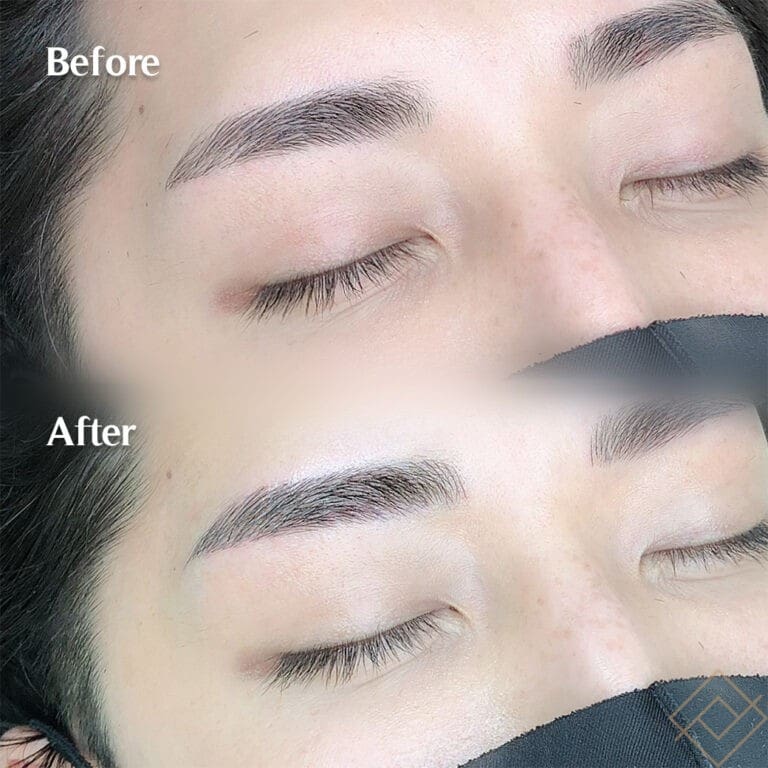 Entry #47 | PGC Products