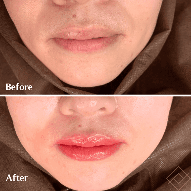 リップ部門 | PGC Products